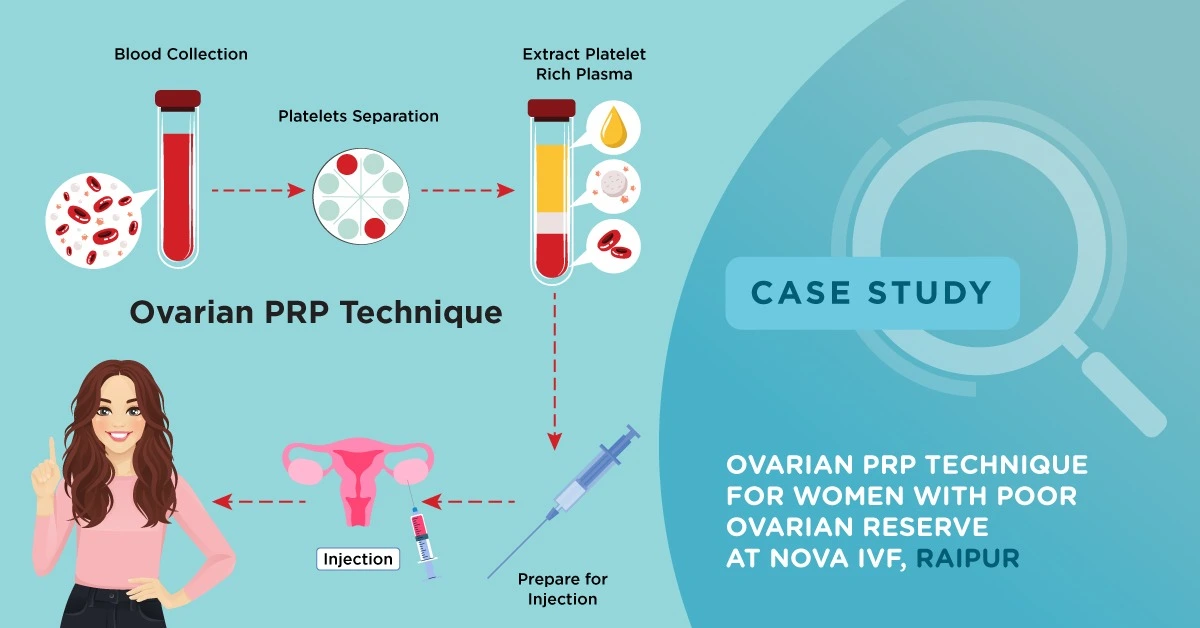 OVARIAN PRP | NOVA IVF